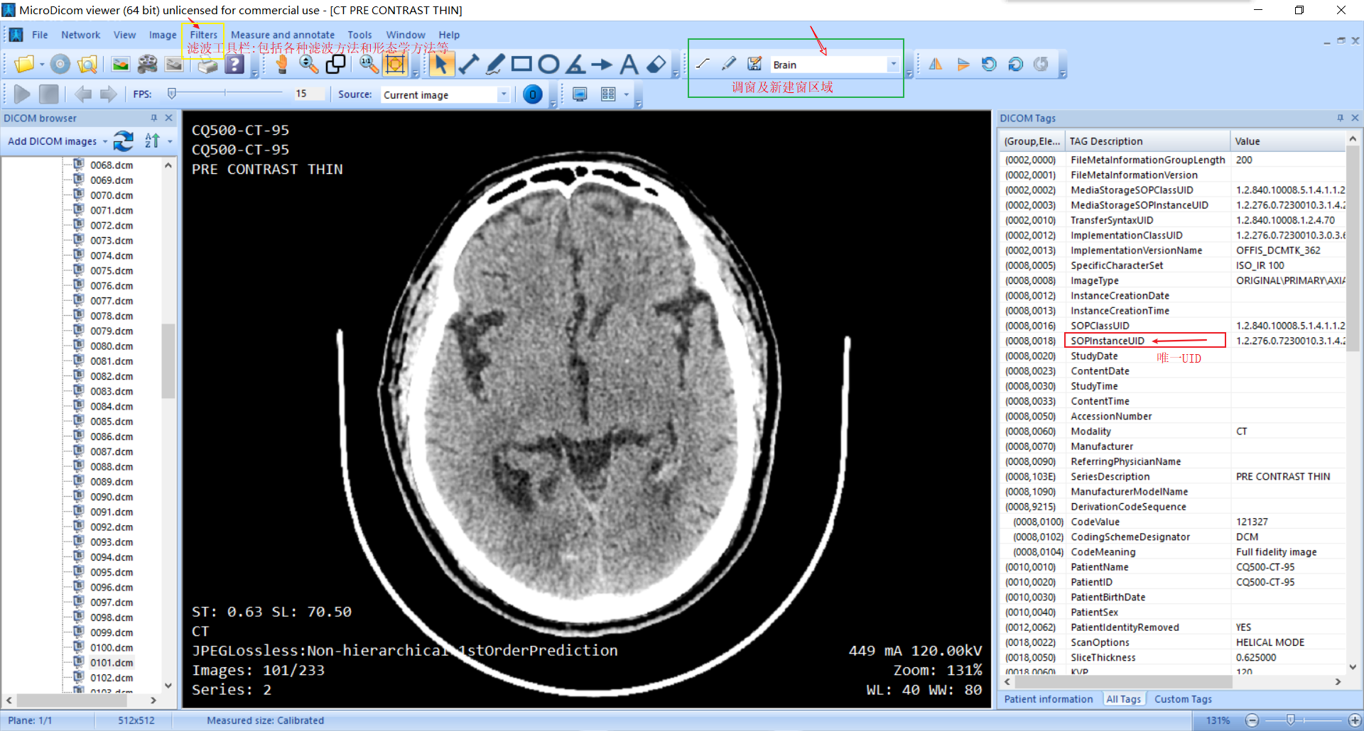 MicroDicom viewer相关_microdicom dicom viewer 右侧alltag参数含义-CSDN博客