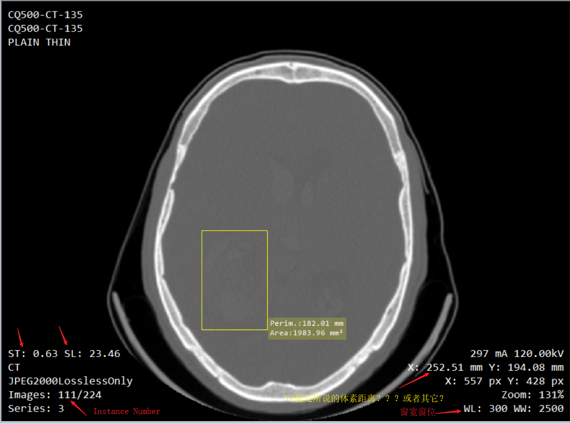 MicroDicom viewer相关_microdicom dicom viewer 右侧alltag参数含义-CSDN博客