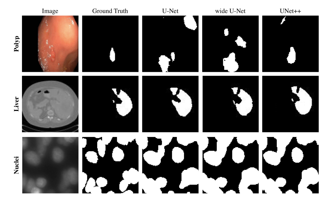[论文翻译]UNet++: A Nested U-Net Architecture for Medical Image ...