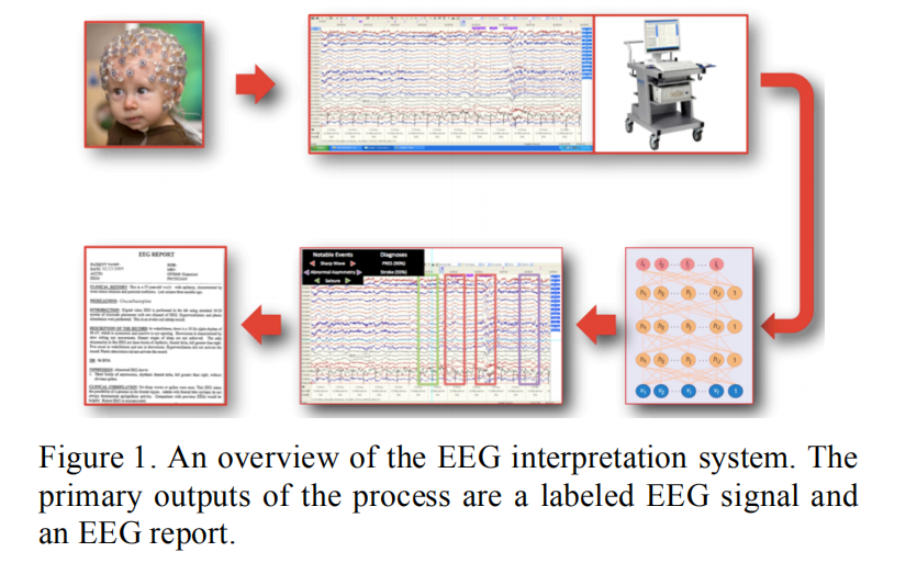 【基于深度学习的脑电图识别】数据集篇：THE TUH EEG CORPUS: A Big Data Resource for Automated EEG Interpretation_tuh脑 ...