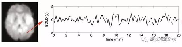 脑功能连接计算之基于种子点的方法_bold-fmri中的功能连接-CSDN博客