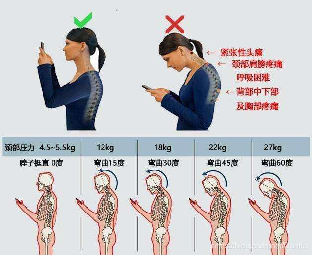 程序员如何保护自己的颈椎?颈椎操程序员保护脊椎 Csdn博客