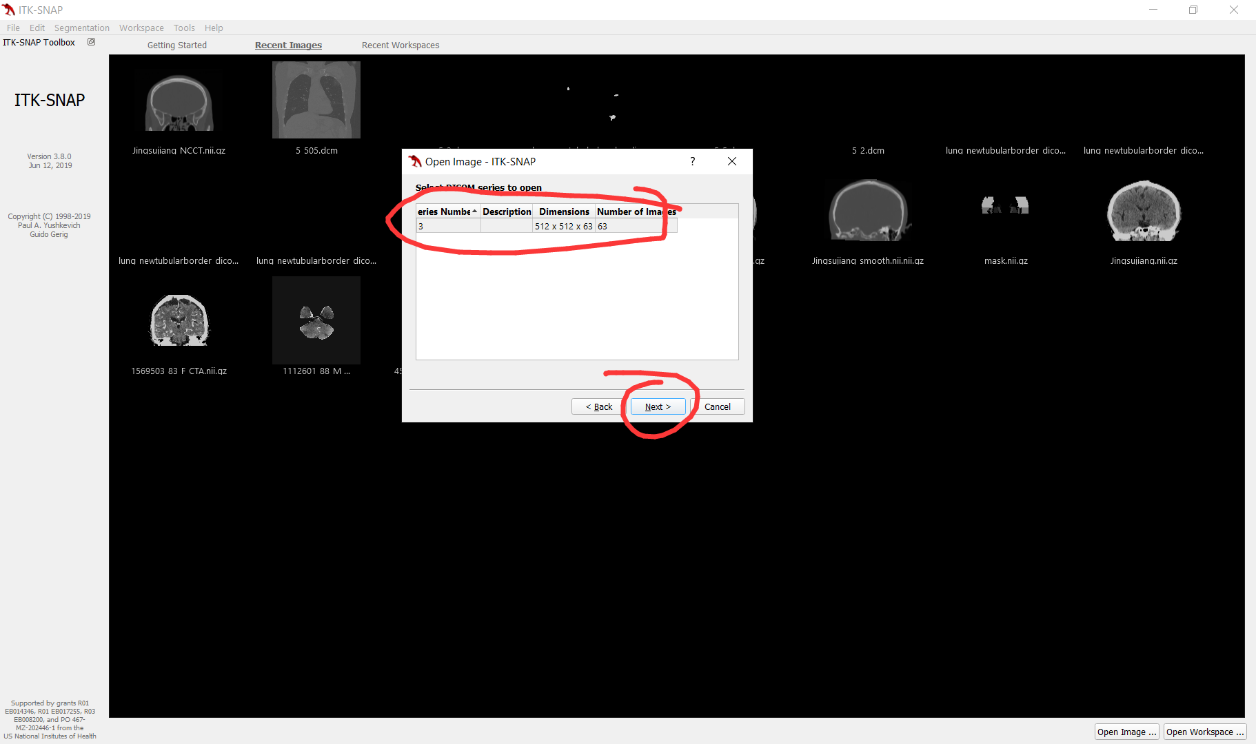 使用ITK-SNAP软件进行医学图像的标注（label标签设置、调整等）（windows版本，如mac和linux操作则略有不同）_itk ...