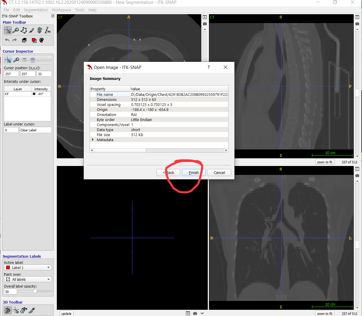 使用ITK-SNAP软件进行医学图像的标注（label标签设置、调整等）（windows版本，如mac和linux操作则略有不同）_itk ...
