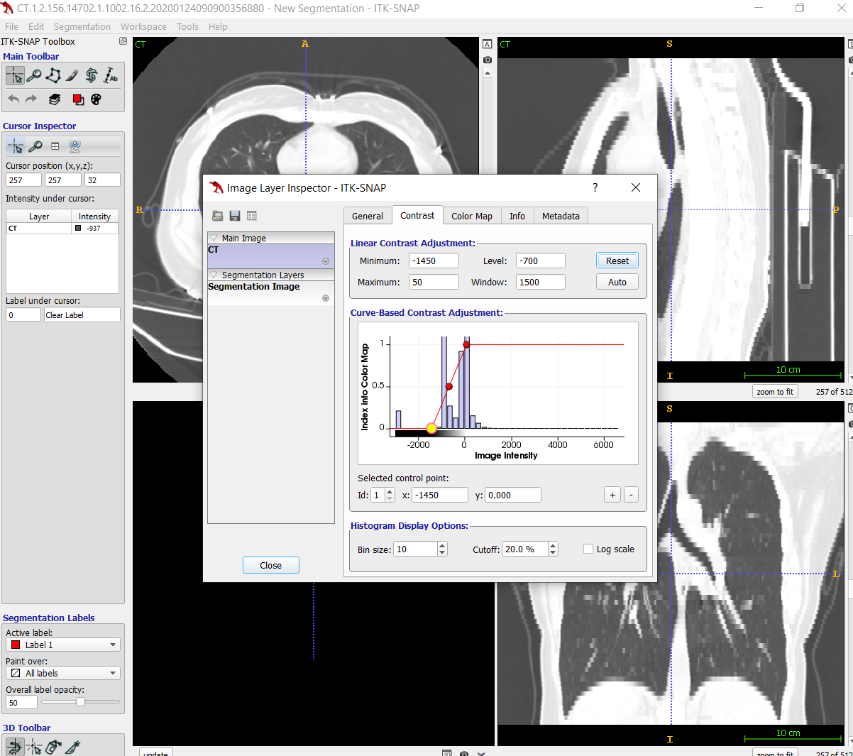 使用ITK-SNAP软件进行医学图像的标注（label标签设置、调整等）（windows版本，如mac和linux操作则略有不同）_itk ...
