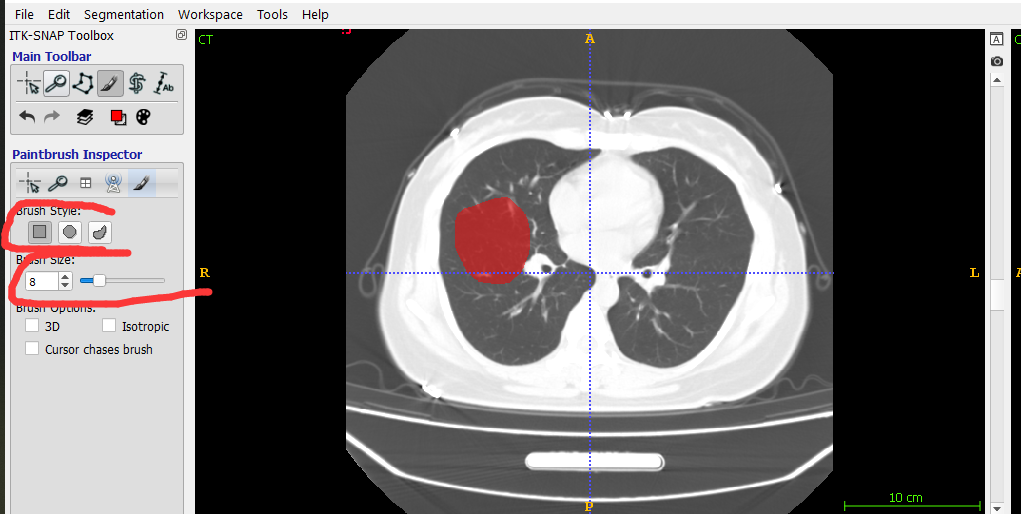 使用ITK-SNAP软件进行医学图像的标注（label标签设置、调整等）（windows版本，如mac和linux操作则略有不同）_itk ...