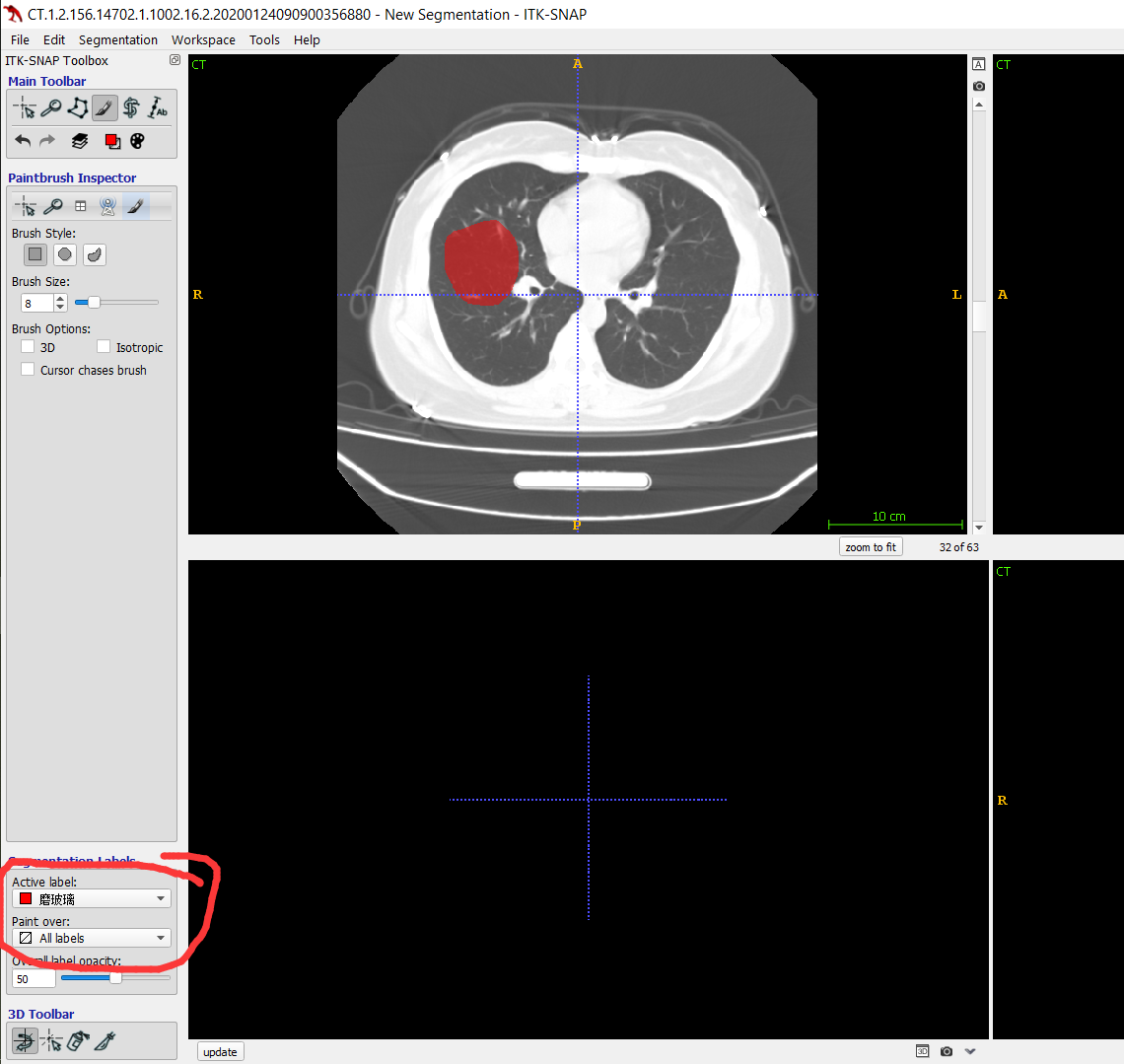 使用ITK-SNAP软件进行医学图像的标注（label标签设置、调整等）（windows版本，如mac和linux操作则略有不同）_itk-snap瘤周-CSDN博客
