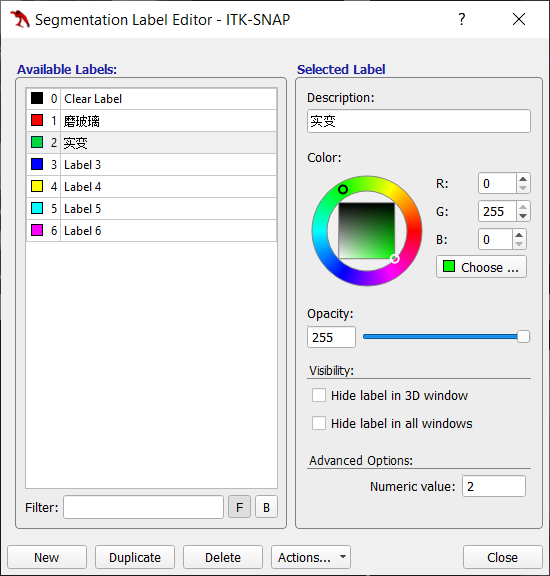 使用ITK-SNAP软件进行医学图像的标注（label标签设置、调整等）（windows版本，如mac和linux操作则略有不同）_itk-snap瘤周-CSDN博客