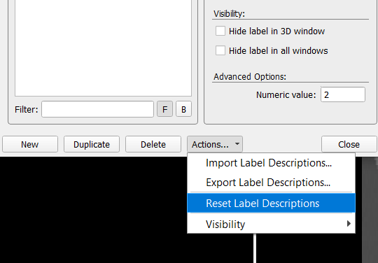 使用ITK-SNAP软件进行医学图像的标注（label标签设置、调整等）（windows版本，如mac和linux操作则略有不同）_itk ...