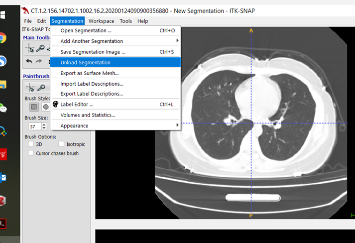 使用ITK-SNAP软件进行医学图像的标注（label标签设置、调整等）（windows版本，如mac和linux操作则略有不同）_itk ...