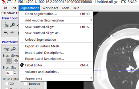 使用ITK-SNAP软件进行医学图像的标注（label标签设置、调整等）（windows版本，如mac和linux操作则略有不同）_itk-snap瘤周-CSDN博客