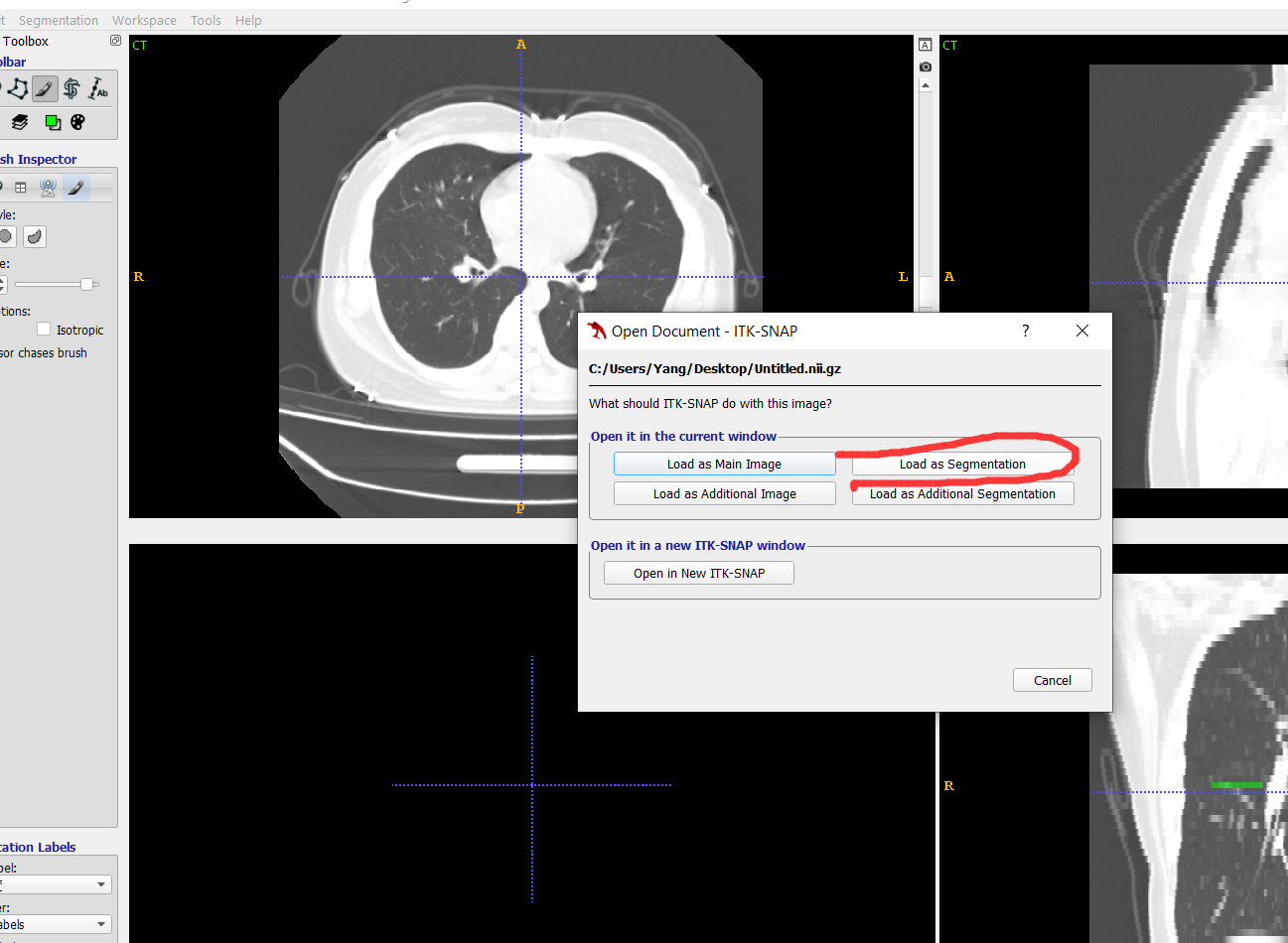 使用ITK-SNAP软件进行医学图像的标注（label标签设置、调整等）（windows版本，如mac和linux操作则略有不同）_itk ...