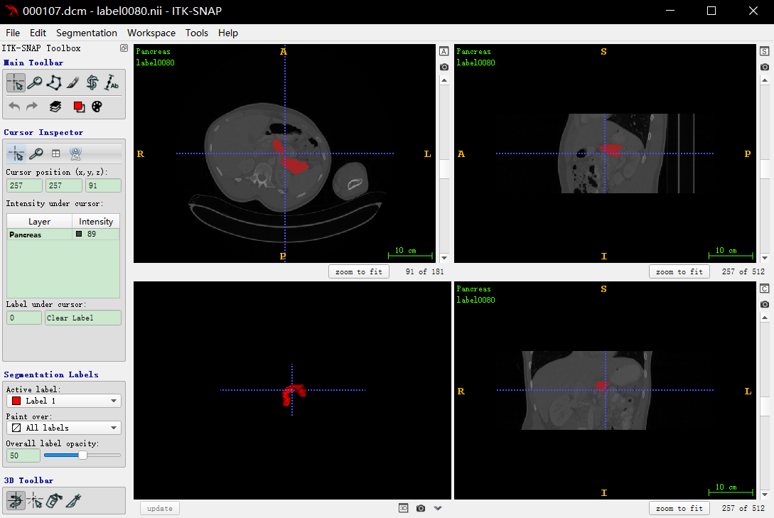医学图像可视化软件ITK-SNAP的使用方法_itksnap下载-CSDN博客