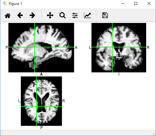 Python Reads Nifti Nii Format Images Programmer Sought