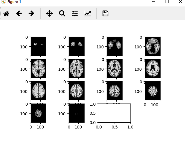 python，matlab 读取NIFTI(.nii)格式图像、FSL安装_nii格式 matlab-CSDN博客