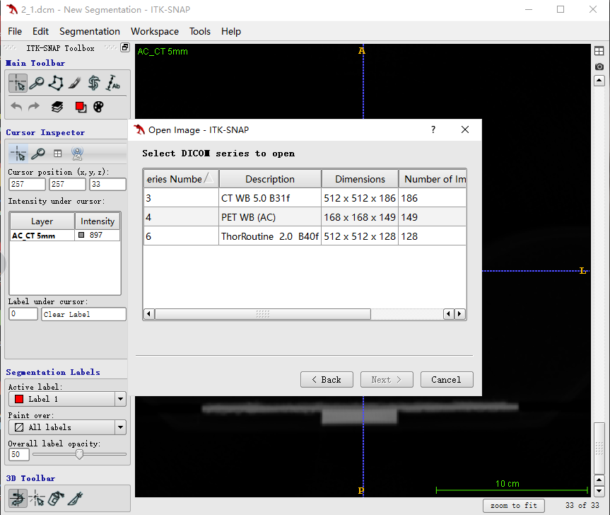 利用SimpleITK读取同一个目录下的多个dicom序列_如果我在一个文件夹中有一系列的dicom文件,分别属于若干个不同的序列。如何将他们-CSDN博客