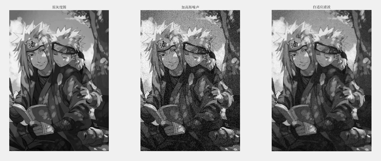 Matlab数字图像处理——图像增强 – 源码巴士