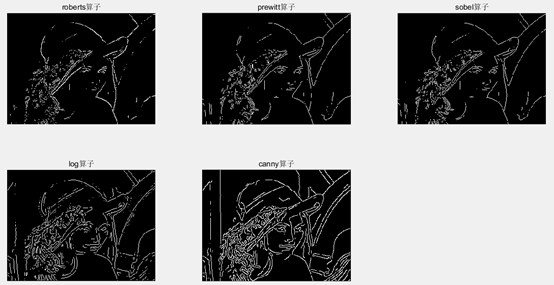 Matlab与FPGA图像处理——Roberts、Prewitt、Sobel、LOG、Canny等常见的图像边缘检测算子比较_《matlab实践》 课程设计obel、prewitt和canny ...