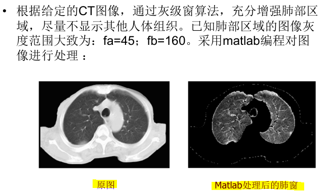 【20200325】数字图像处理dip课程课业打卡三之图像增强采用灰级窗算法增强ct图像中的肺部区域 Csdn博客 