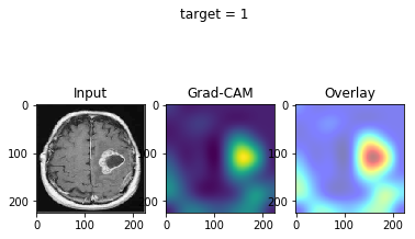 使用Grad_Cam绘制预训练模型VGG16训练脑部MRI图像的类激活图_gradcam测试图片-CSDN博客