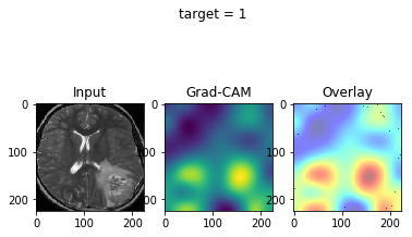使用Grad_Cam绘制预训练模型VGG16训练脑部MRI图像的类激活图_gradcam测试图片-CSDN博客