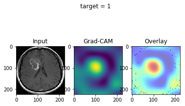 使用Grad_Cam绘制预训练模型VGG16训练脑部MRI图像的类激活图_gradcam测试图片-CSDN博客