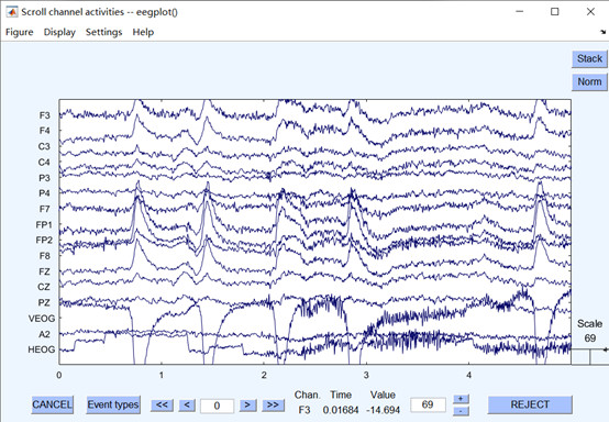 ERPLAB中文教程：ERPLAB安装与添加通道-CSDN博客