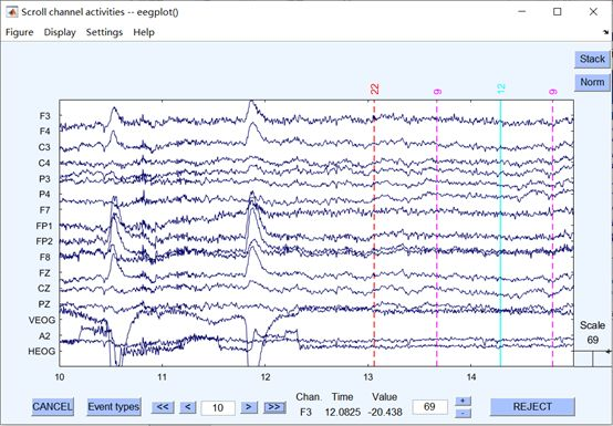 ERPLAB中文教程：创建与查看EventList_eeglab erp event记录-CSDN博客