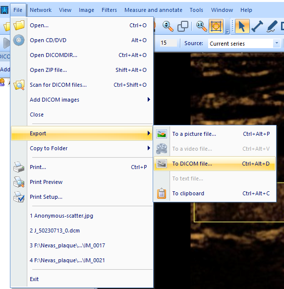 使用Microdicom软件将jpg转dicom_microdicom处理dicom文件-CSDN博客