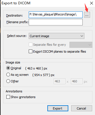 使用Microdicom软件将jpg转dicom_microdicom处理dicom文件-CSDN博客