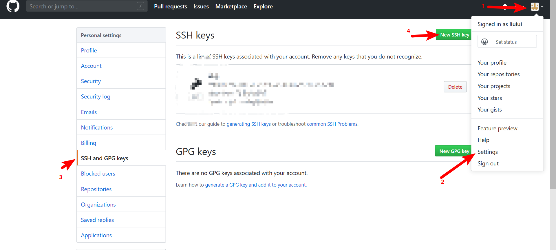 Git安装_doctor.diag.git.configure-CSDN博客