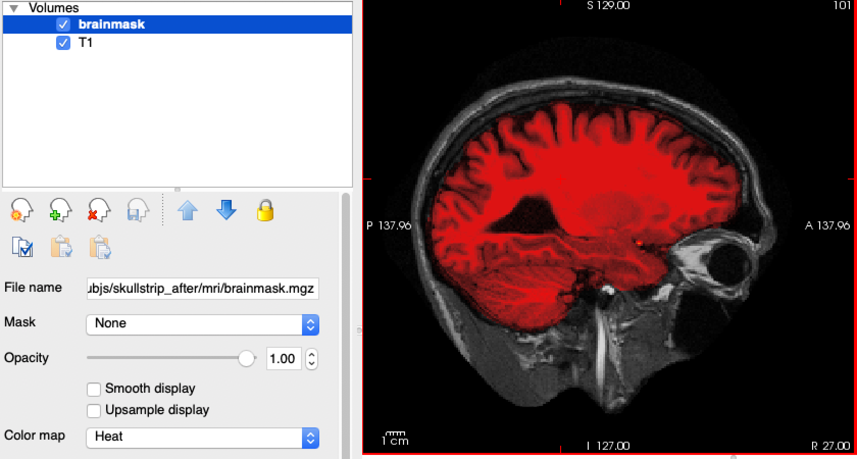 Freesurfer学习笔记——Fixing a bad skull strip3.4_freesurfer怎么看颅骨有没有剥干净-CSDN博客