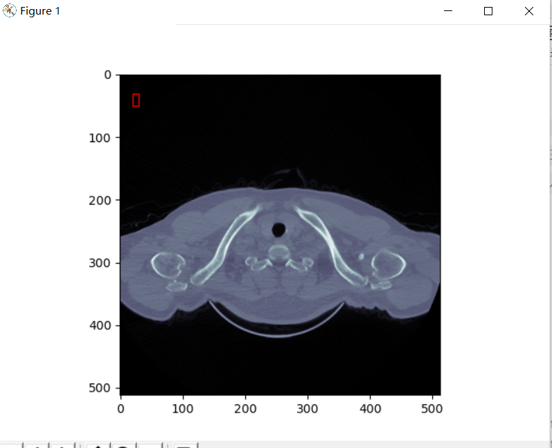 Deeplung:深度学习项目笔记（二）——医学影像学dicom,mhd及raw文件读取与可视化_医学raw查看-CSDN博客
