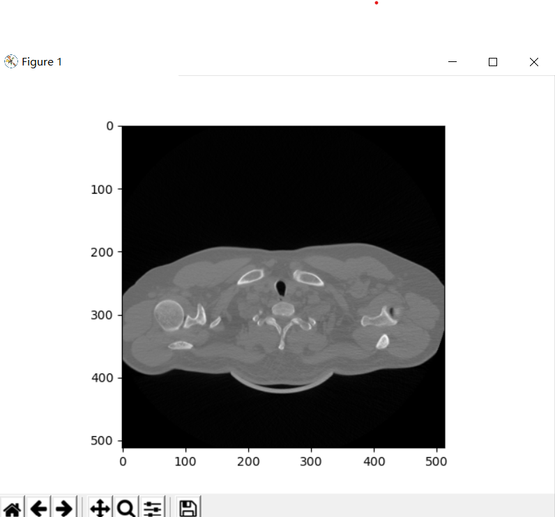 Deeplung:深度学习项目笔记（二）——医学影像学dicom,mhd及raw文件读取与可视化_医学raw查看-CSDN博客