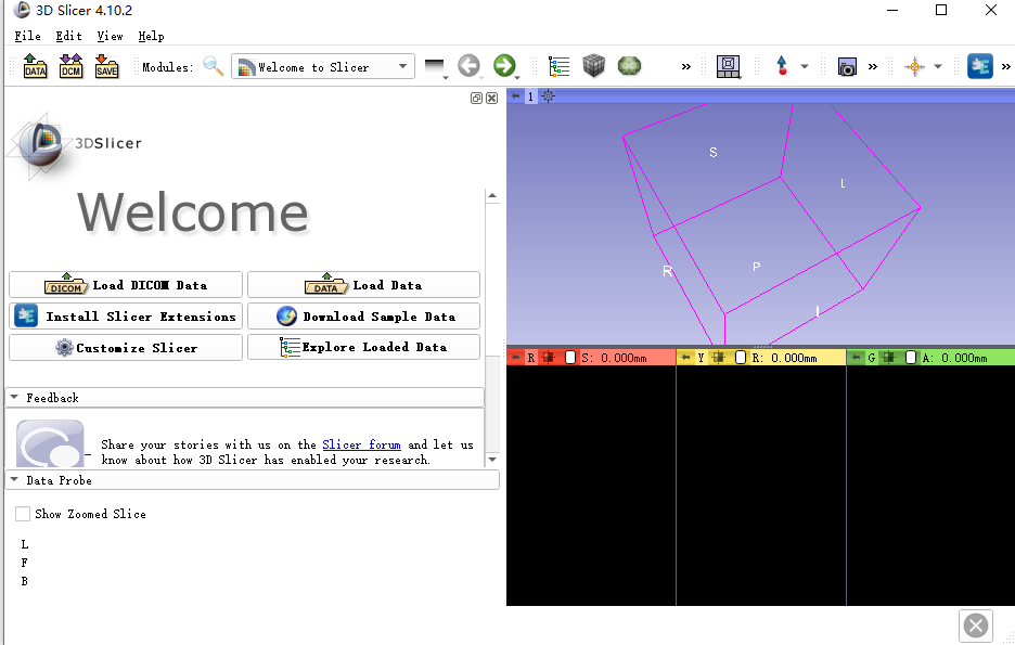 超级简单的3D slicer使用教程（一）_3d slicer教程-CSDN博客