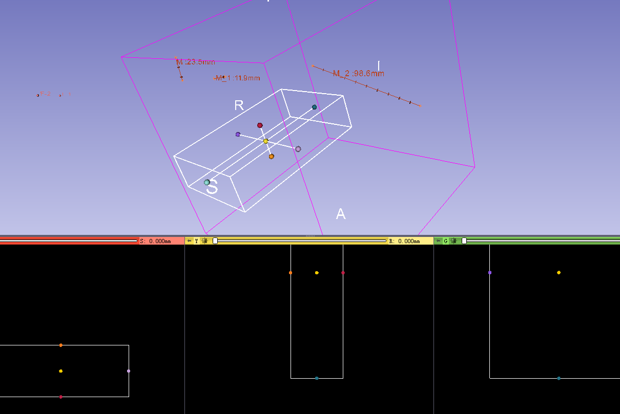 超级简单的3D slicer使用教程（一）_3d slicer教程-CSDN博客