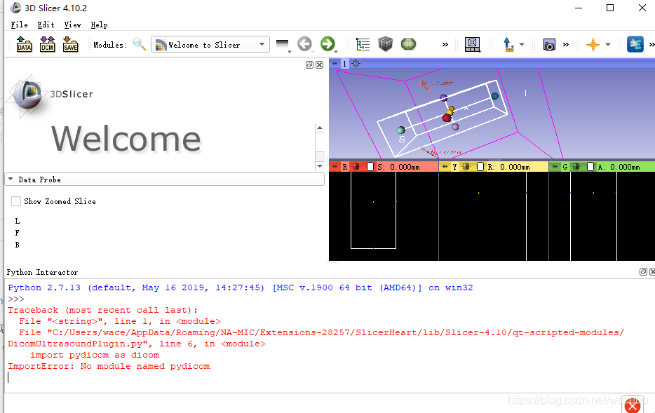 超级简单的3d Slicer使用教程(一)3d Slicer教程 Csdn博客