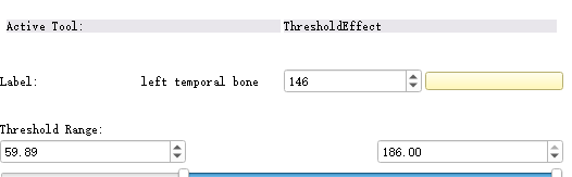 超级简单的3D slicer教程（三）creating label Map_3d slicer roi删除-CSDN博客