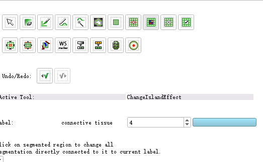超级简单的3D slicer教程（三）creating label Map_3d slicer roi删除-CSDN博客