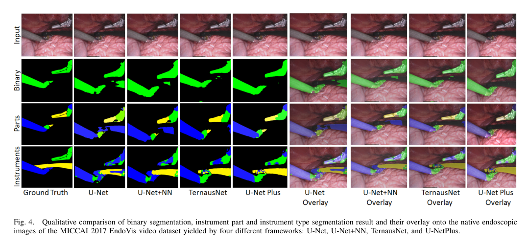 论文阅读——U-NetPlus: A Modified Encoder-Decoder UNet Architecture for Semantic and Instance ...