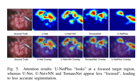 论文阅读——U-NetPlus: A Modified Encoder-Decoder UNet Architecture for Semantic and Instance ...