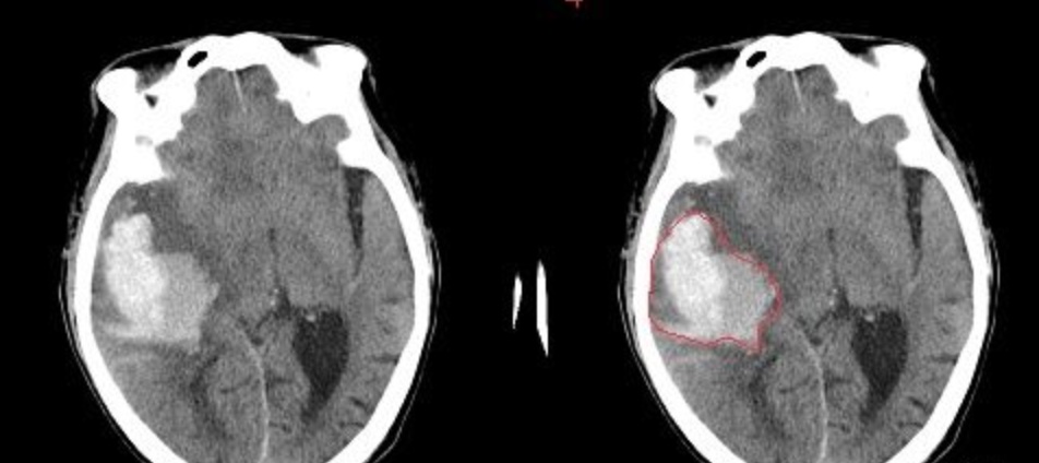 6.3 SegNet与U-Net_segnet和unet-CSDN博客