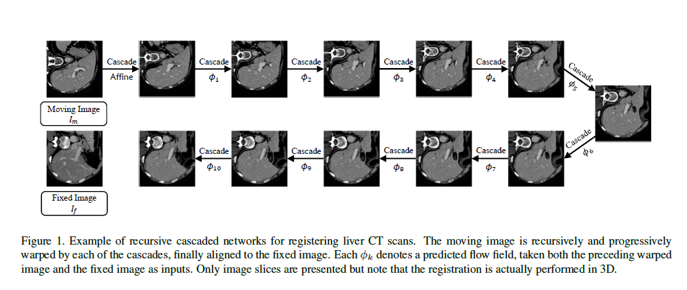 Recursive Cascaded Networks for Unsupervised Medical Image Registration-CSDN博客