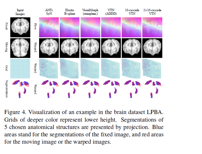 Recursive Cascaded Networks for Unsupervised Medical Image Registration ...