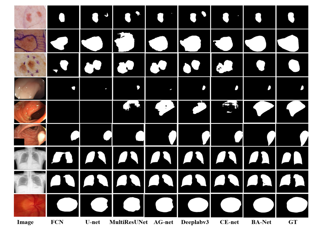 医学图像分割新网络：Boundary-aware Context Neural Network for Medical Image Segmentation_医学图像语义分割网络-CSDN博客