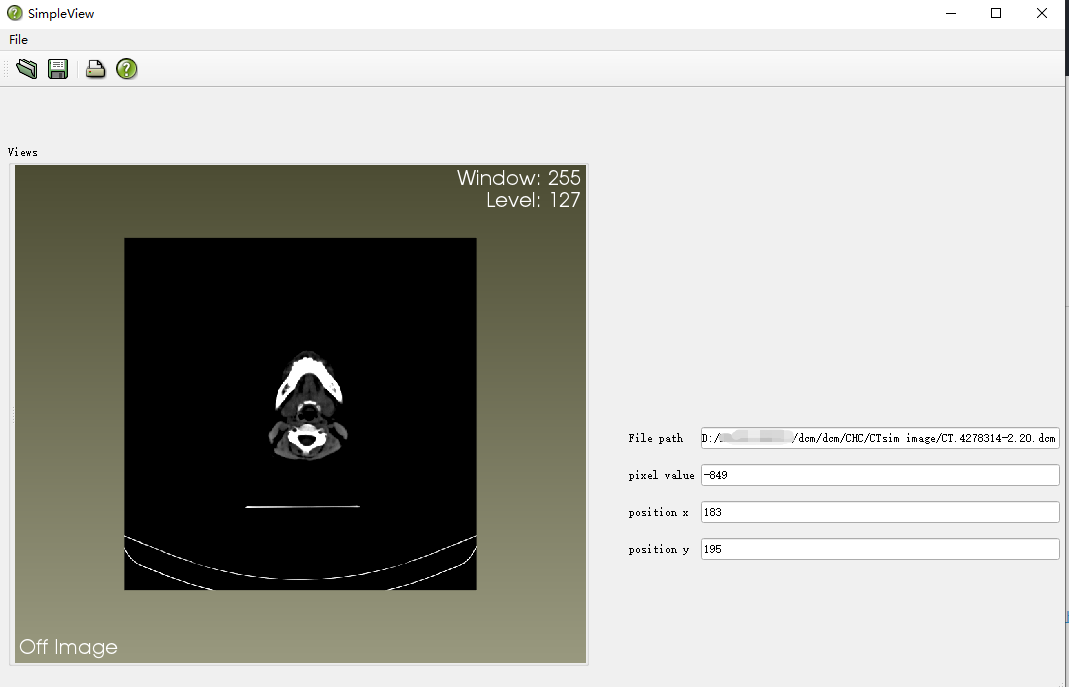【VTK】VTK+QT打开dicom图像并实时显示鼠标坐标位置和像素值_qt vtk dicom-CSDN博客