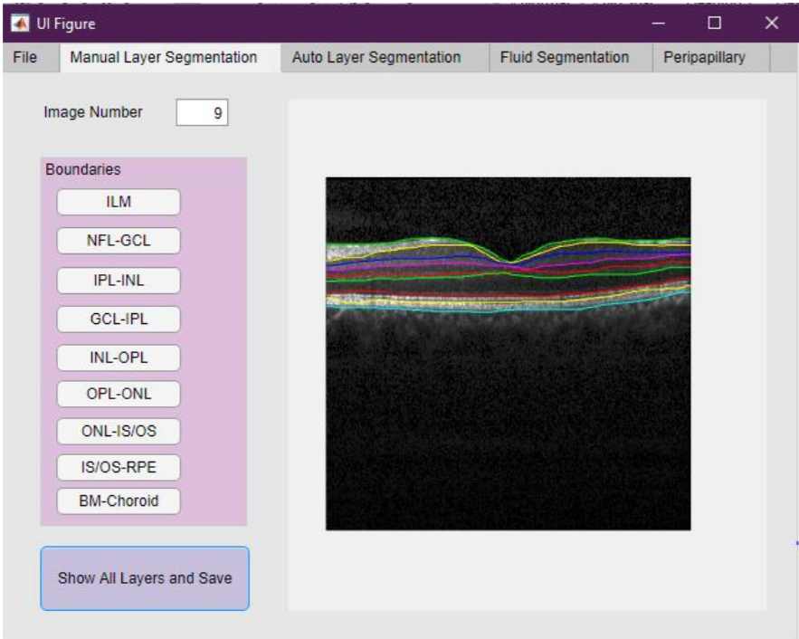 好物推荐：眼科OCT影像自动分割工具推荐_眼科图像处理 排名-CSDN博客