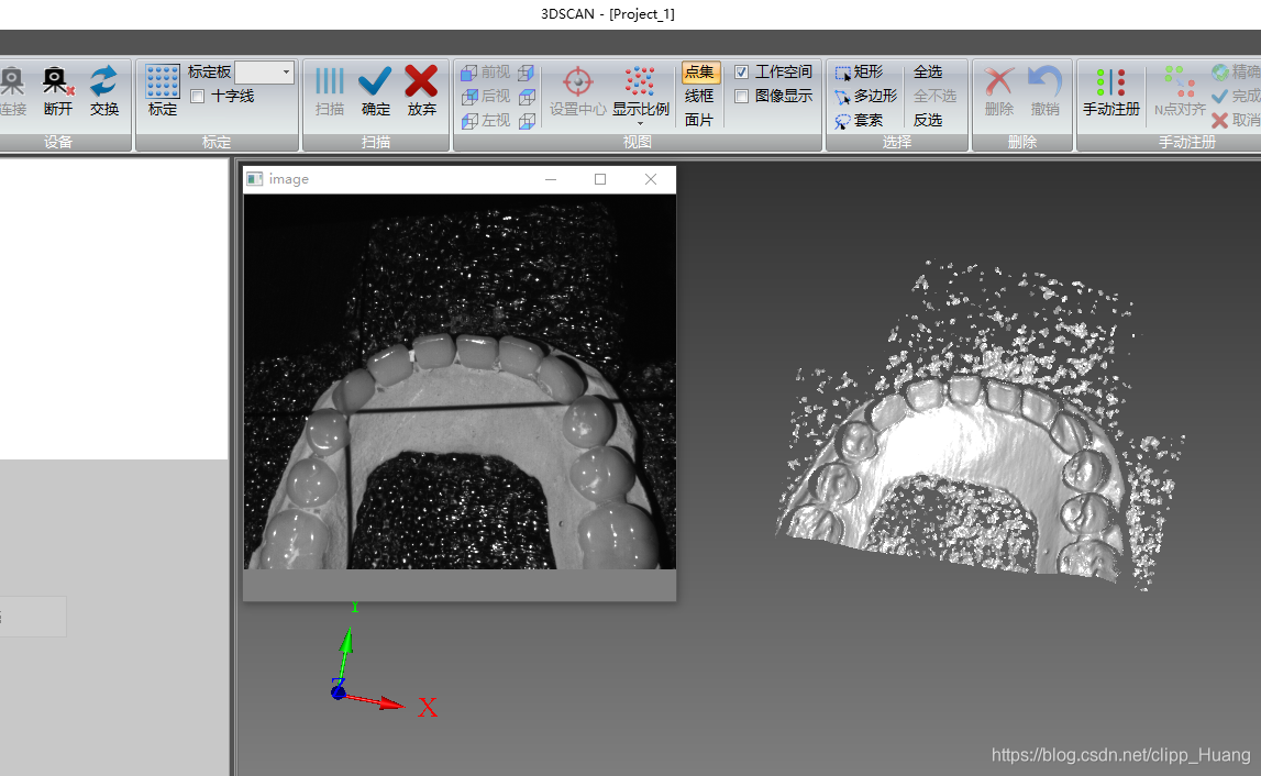 基于单目快速投影的牙模三维重建基于结构光的口腔牙齿3d扫描重建系统设计方案 Csdn博客