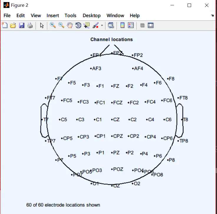 手把手教你EEG脑电数据预处理-操作篇_eeglab基线校正-CSDN博客