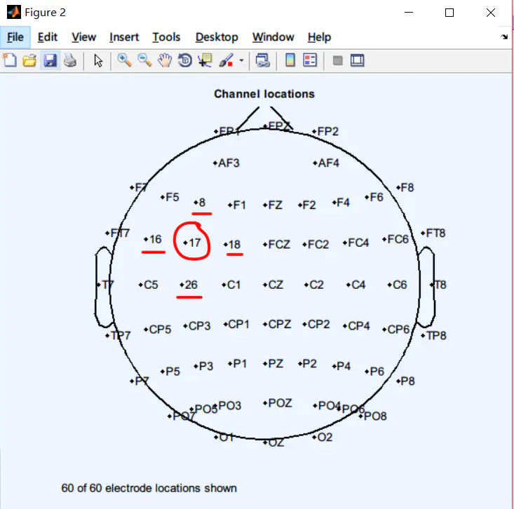 手把手教你EEG脑电数据预处理-操作篇_eeglab基线校正-CSDN博客